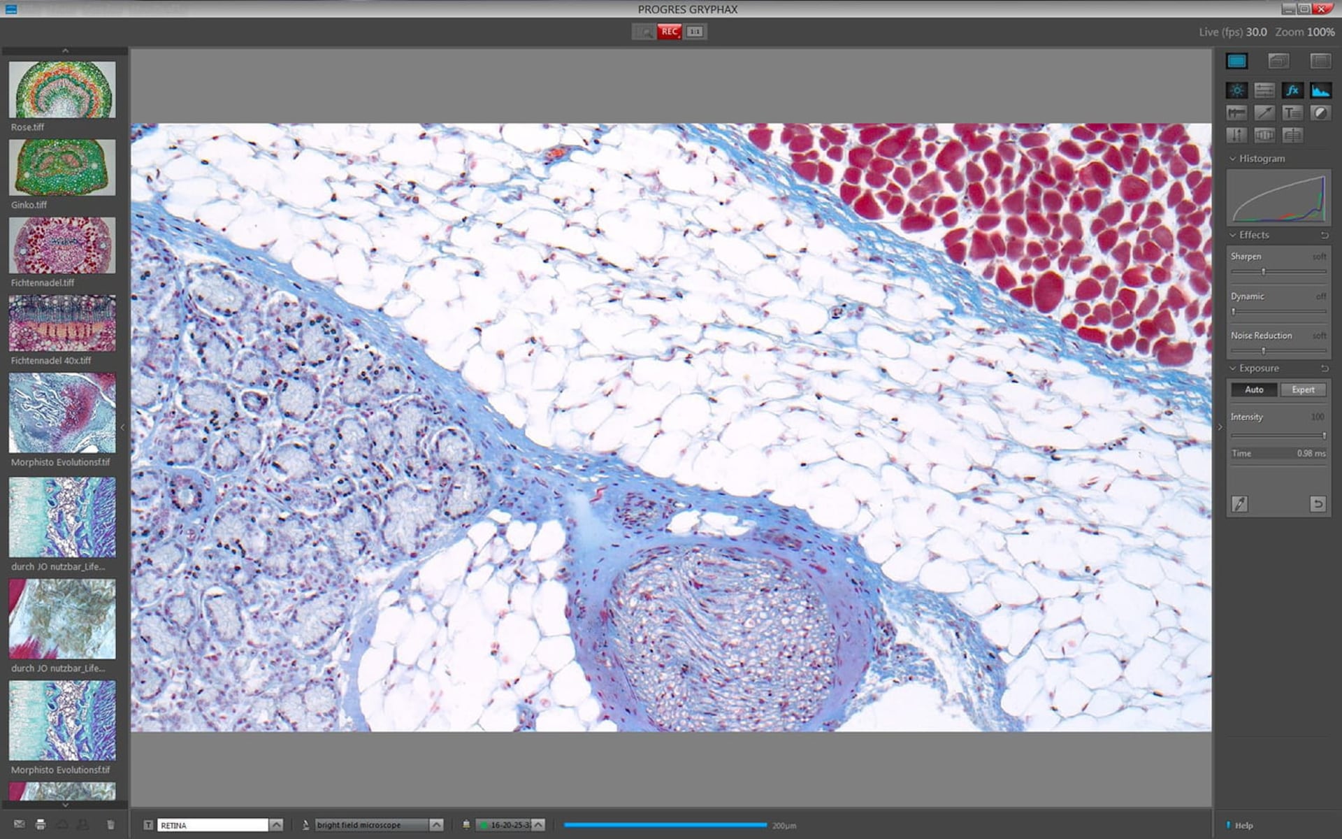 USB cameras for microscopy imaging: use the full microscope power ...